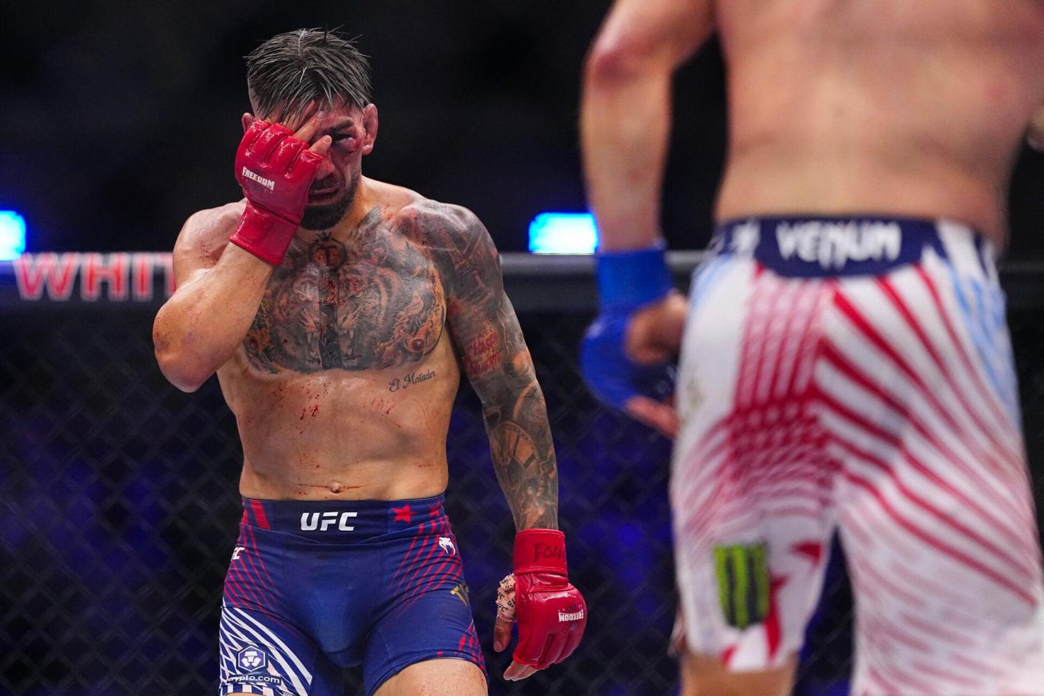 Ilia Topuria Diagnosed With Non-Displaced Orbital Fractures in Both Eyes